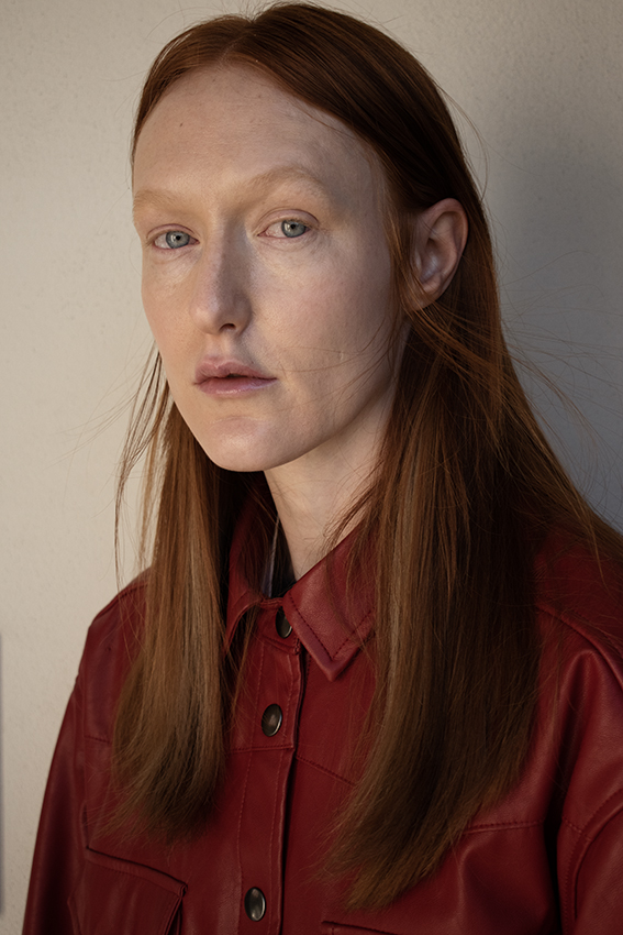 KIM DAVIS - Dew Management
