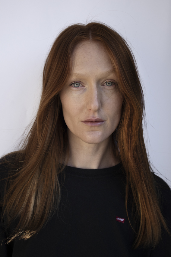 KIM DAVIS - Dew Management